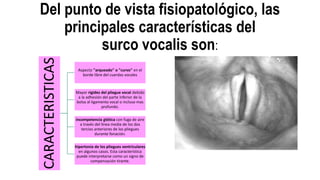 Sulcus vocales expo | PPTX