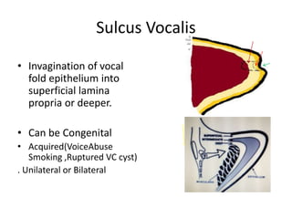 Sulcus vocalis | PPTX | Ear, Nose and Throat Conditions | Diseases and ...