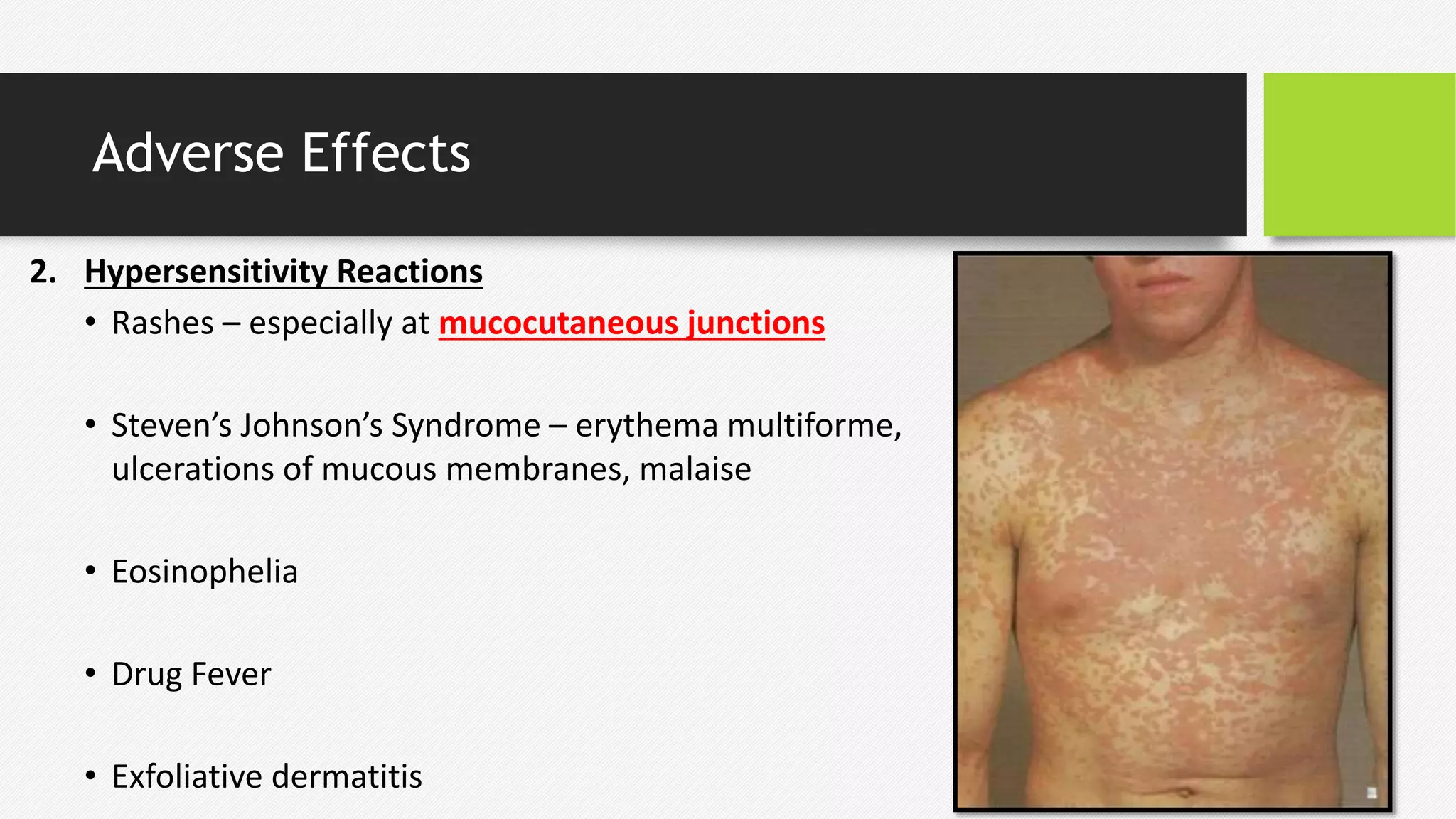 Sulfonamides | PPTX
