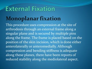 Knee Arthrodesis | PPTX