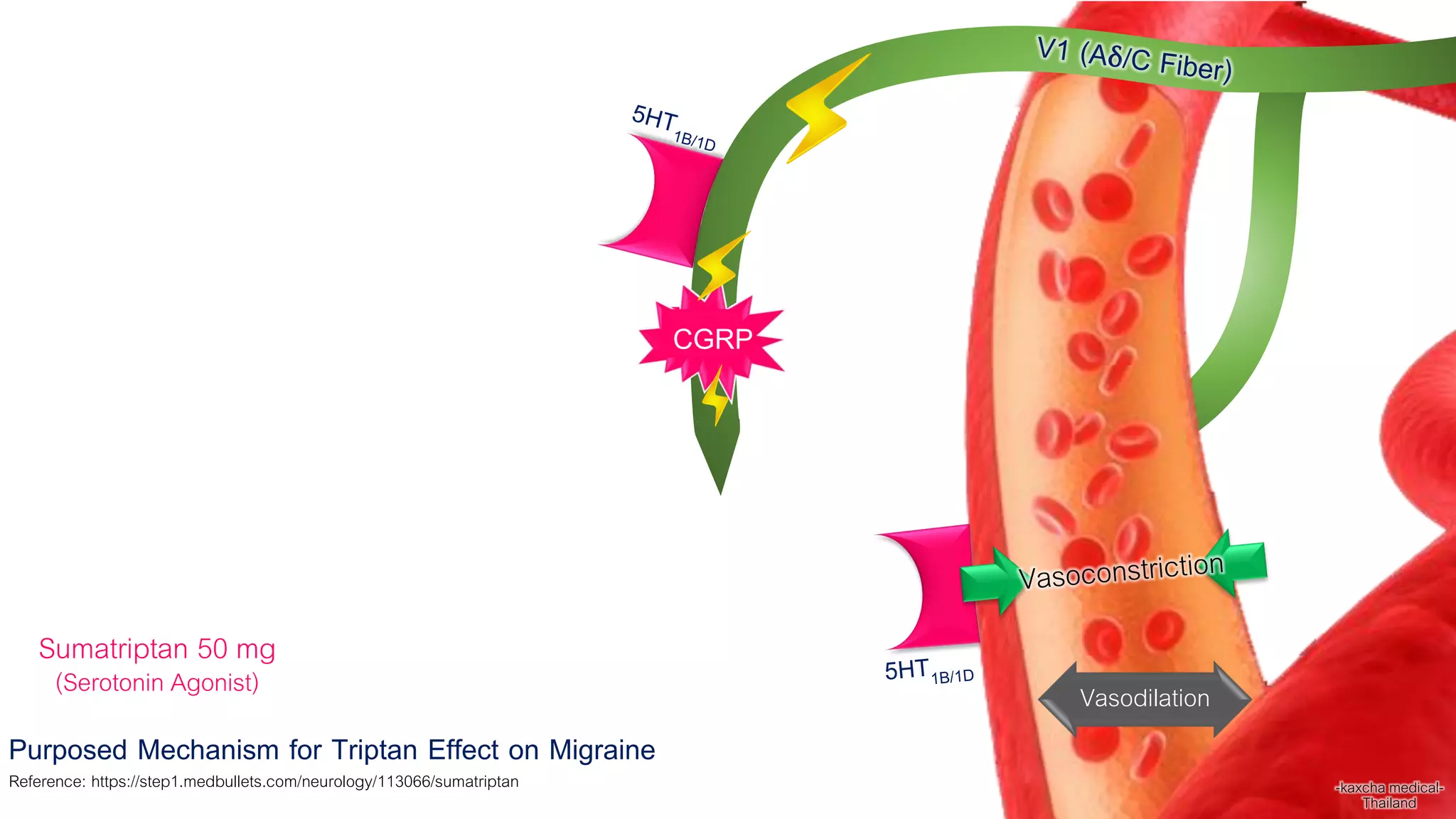 Sumatriptan and migraine | PDF