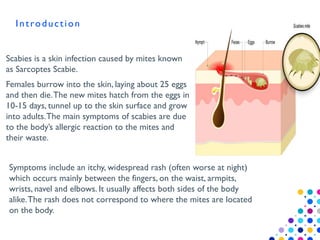 Nabshsbsjsbebjeb IWS dermatology Scabies.pptx