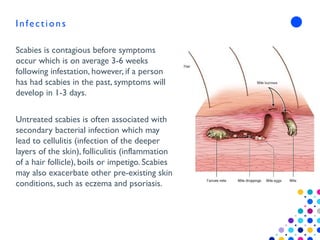 Sumbul Parveen GM20-115 IWS dermatology Scabies.pptx