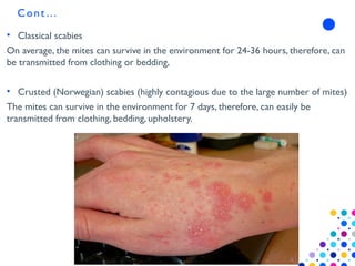 Sumbul Parveen GM20-115 IWS dermatology Scabies.pptx