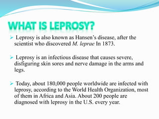 Leprosy presentation | PPT
