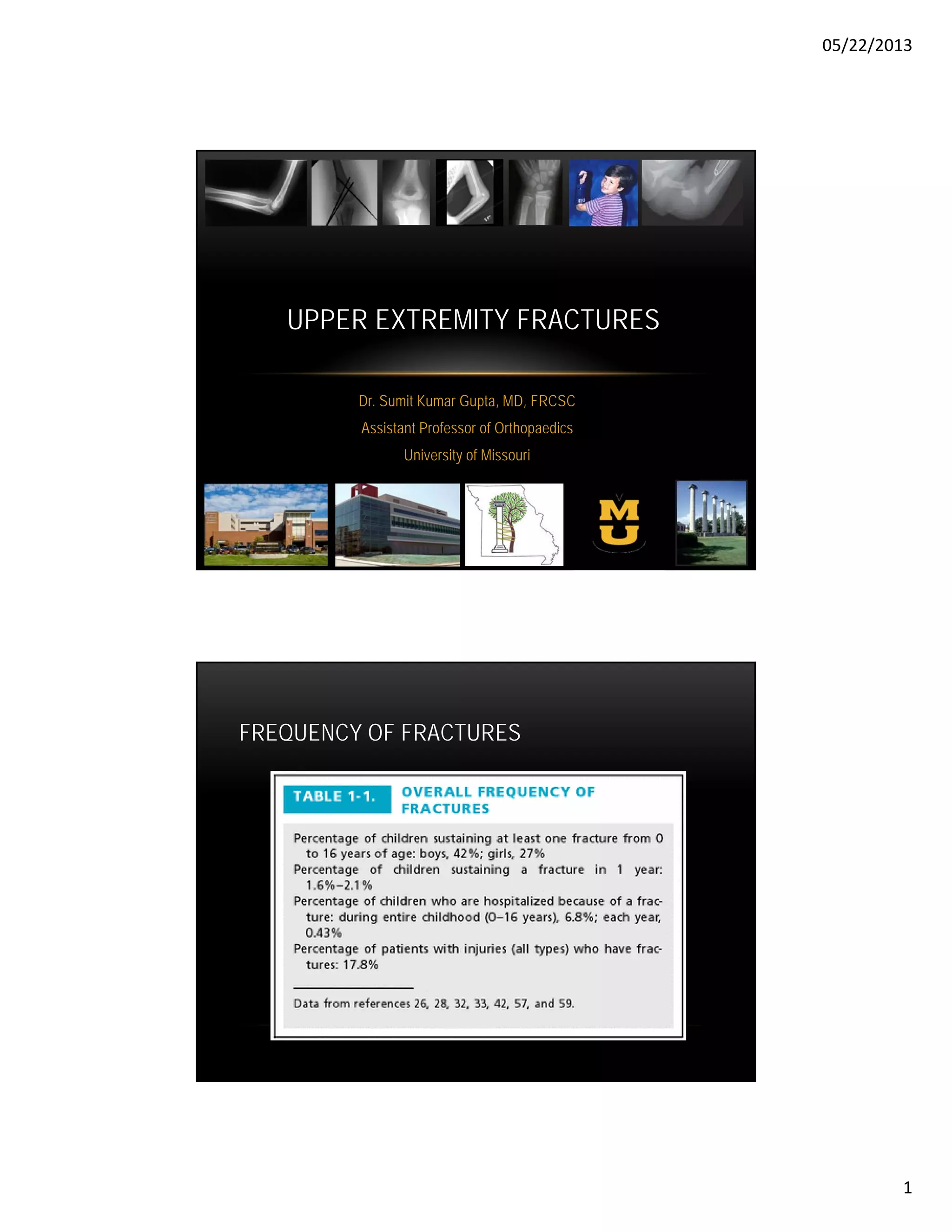 Common Fractures Of Upper Limb | PDF