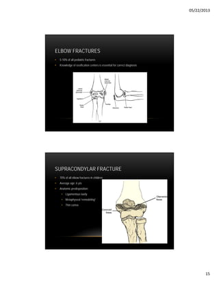 Common Fractures Of Upper Limb | PDF