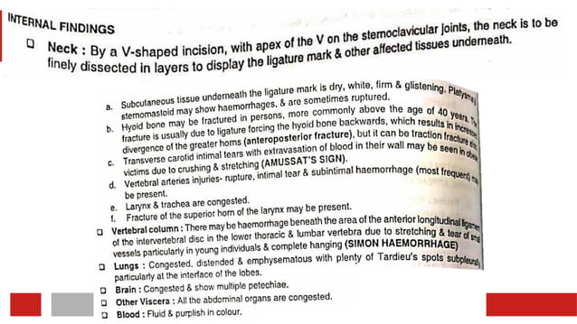 Medico-legal case Hanging by Sumit Kundu FMT PPT.pptx