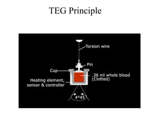 thromboelastography | PPT