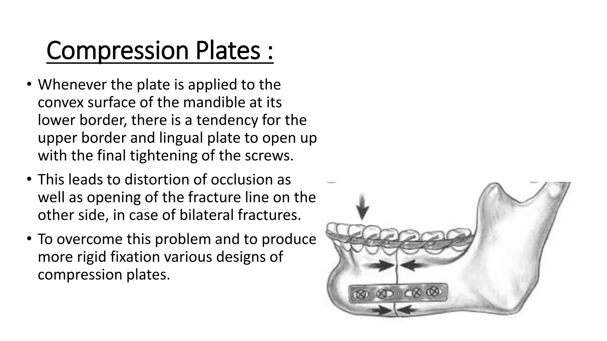 SUM MANDIBULAR.pptx