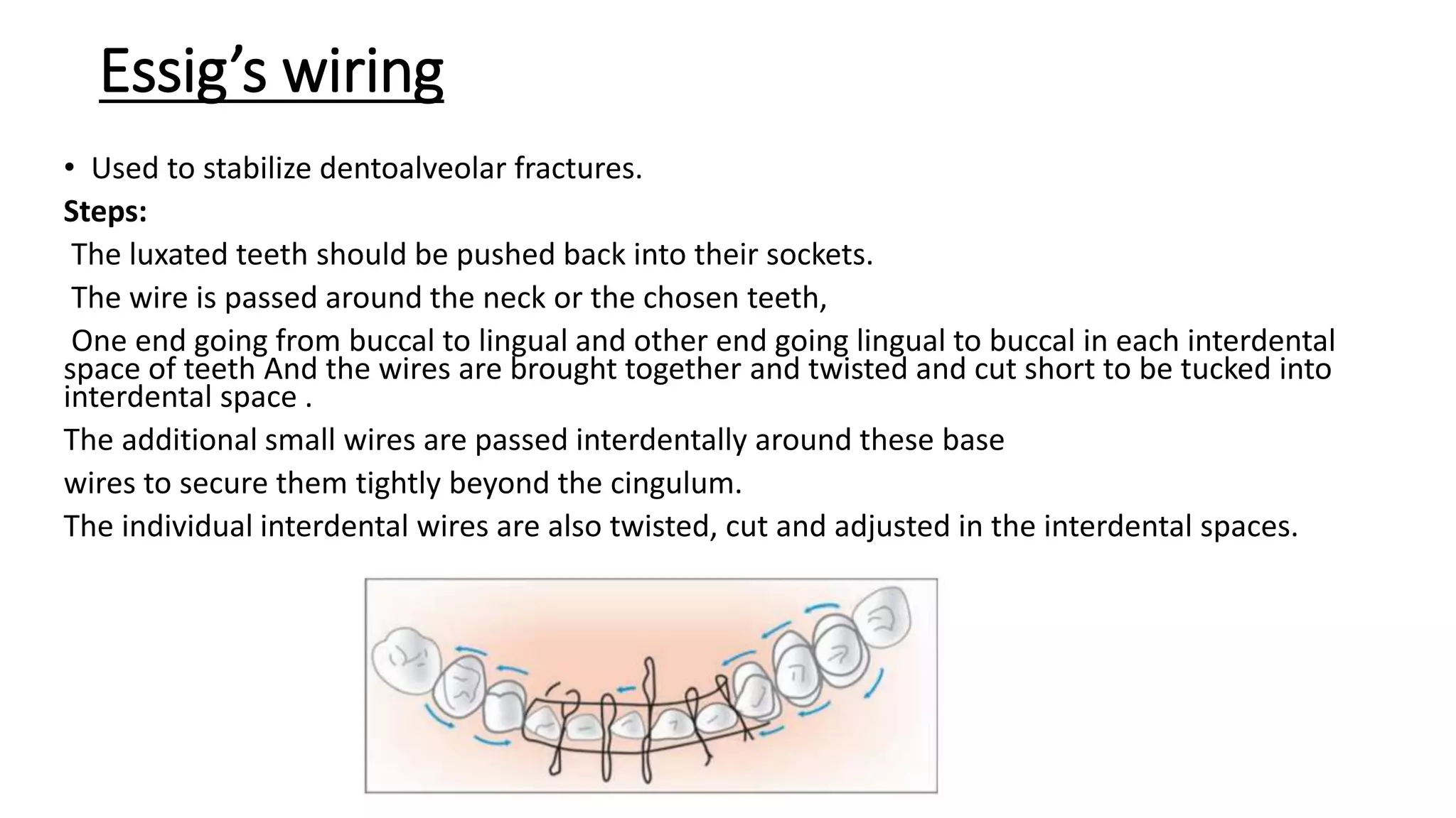 SUM MANDIBULAR.pptx