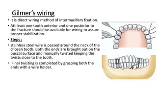 SUM MANDIBULAR.pptx