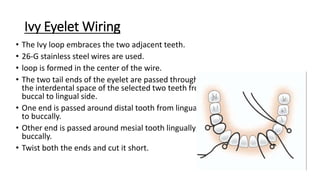 SUM MANDIBULAR.pptx