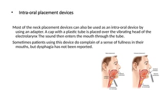 Summary laryngectomy.. post laryngectomy | PPT