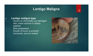 summary of all pathology_LT………………………...pdf