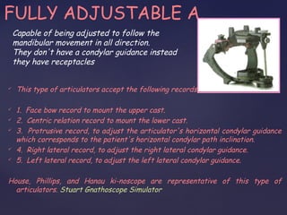 Summary of articulators in prosthodontics | PPT