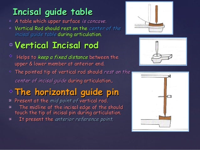 Summary of articulators in prosthodontics