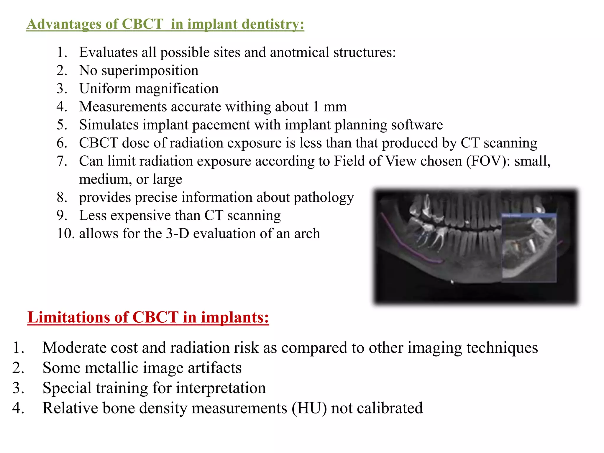CBCT in Implants- Summary | PPTX