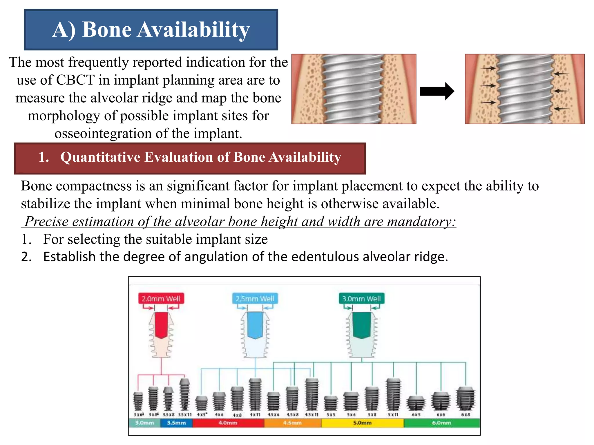 CBCT in Implants- Summary | PPTX