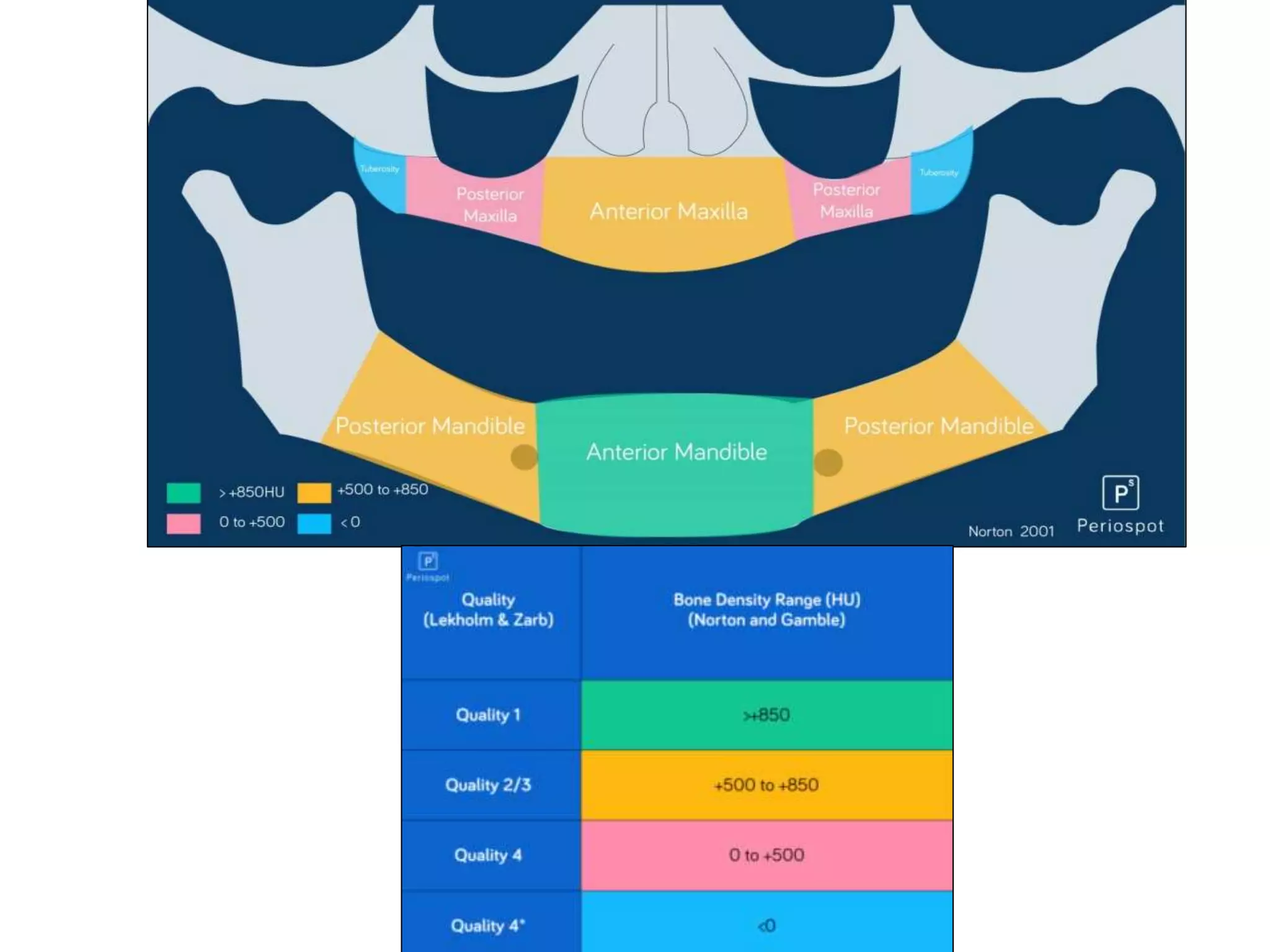 CBCT in Implants- Summary | PPTX