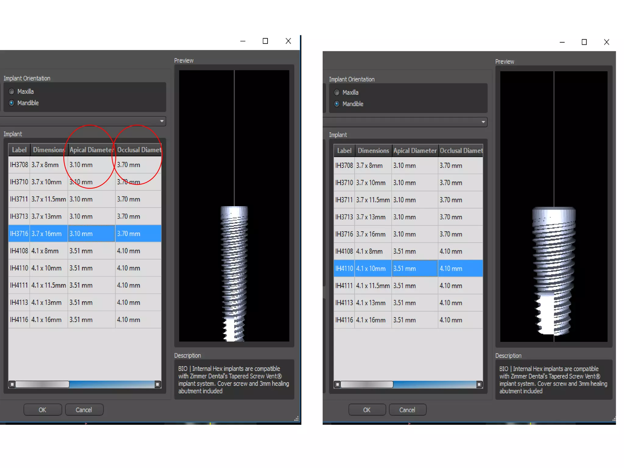 CBCT in Implants- Summary | PPTX