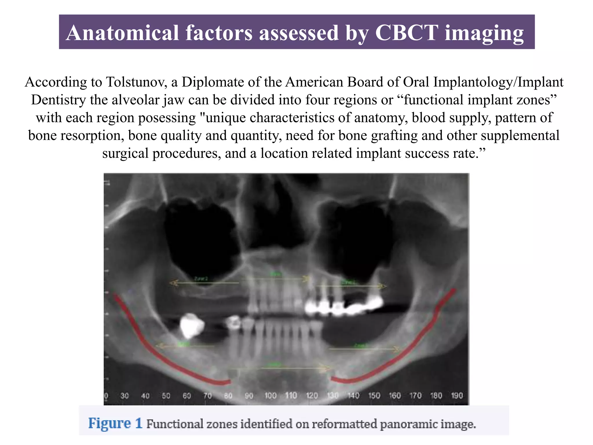 CBCT in Implants- Summary | PPTX