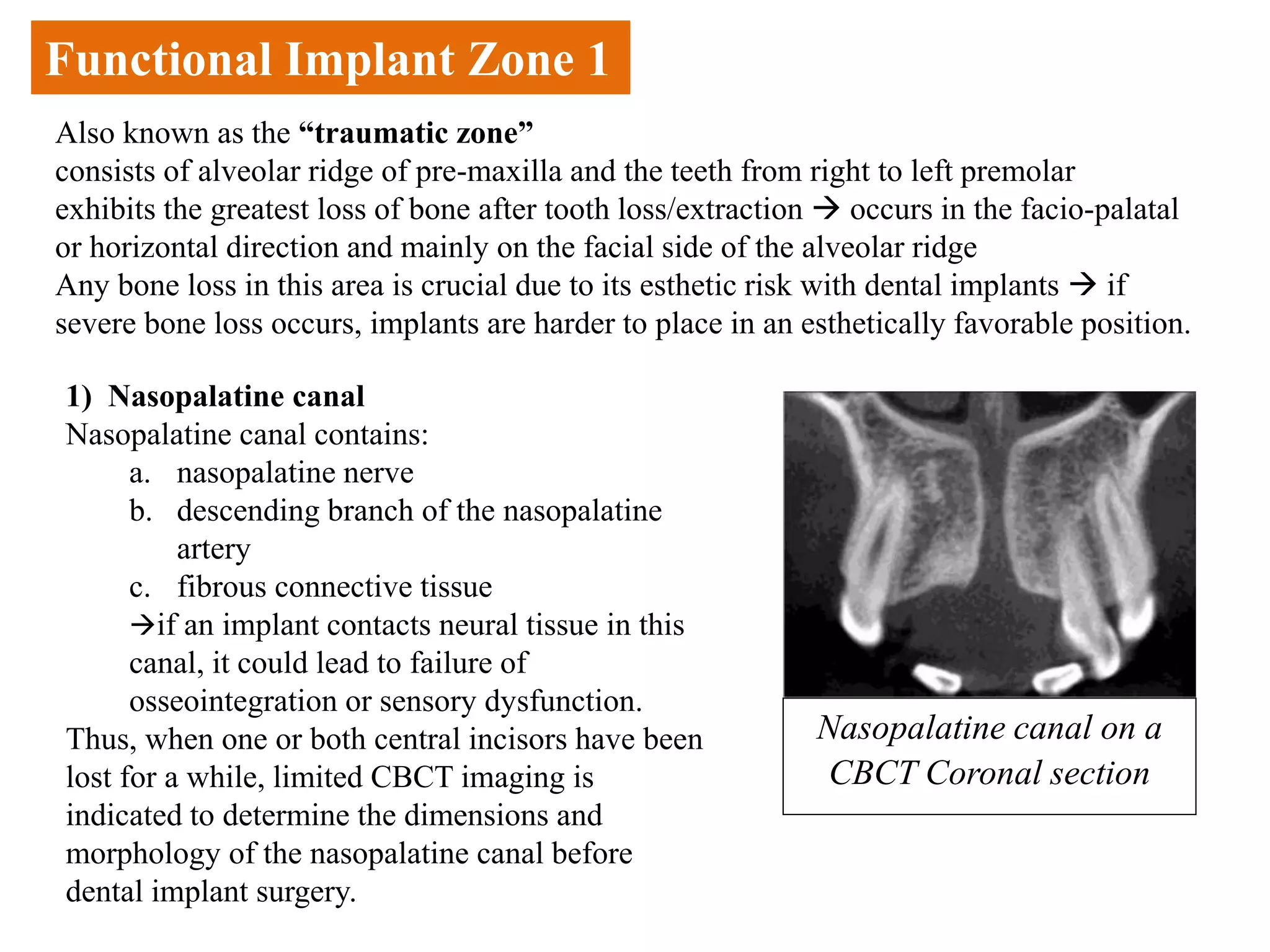 CBCT in Implants- Summary | PPTX