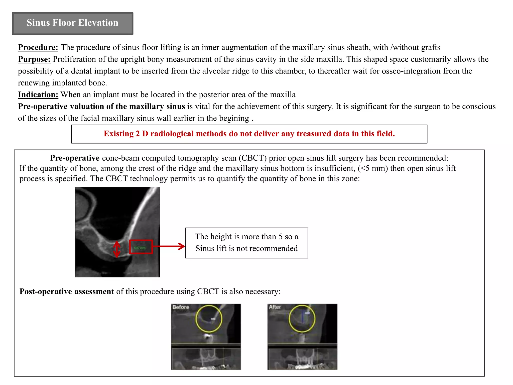CBCT in Implants- Summary | PPTX