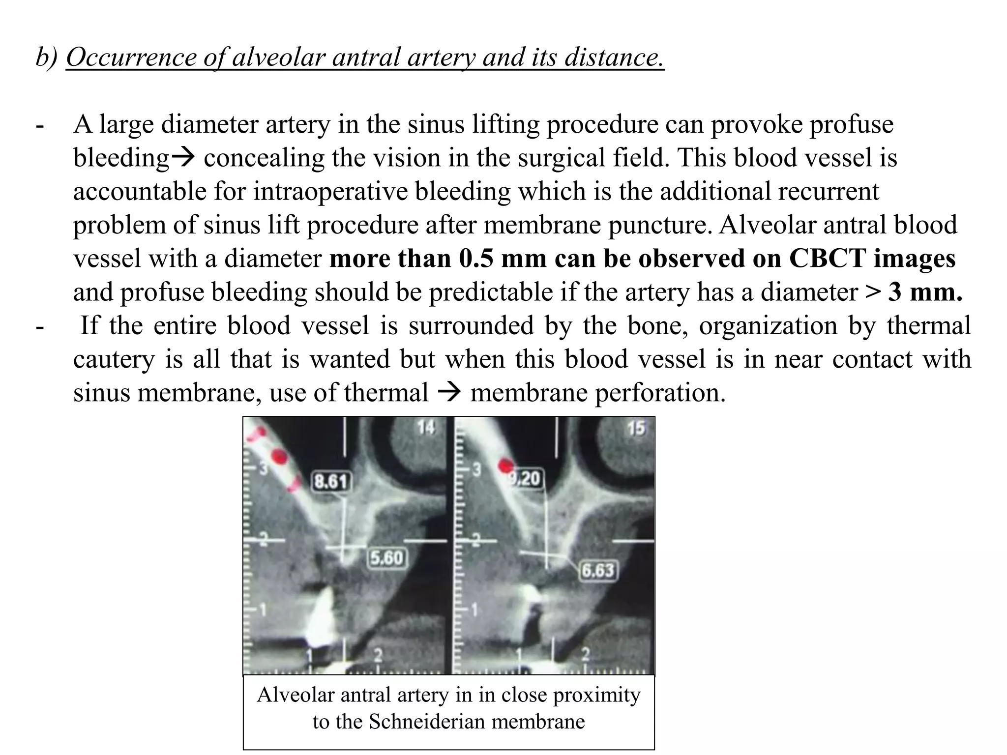 CBCT in Implants- Summary | PPTX