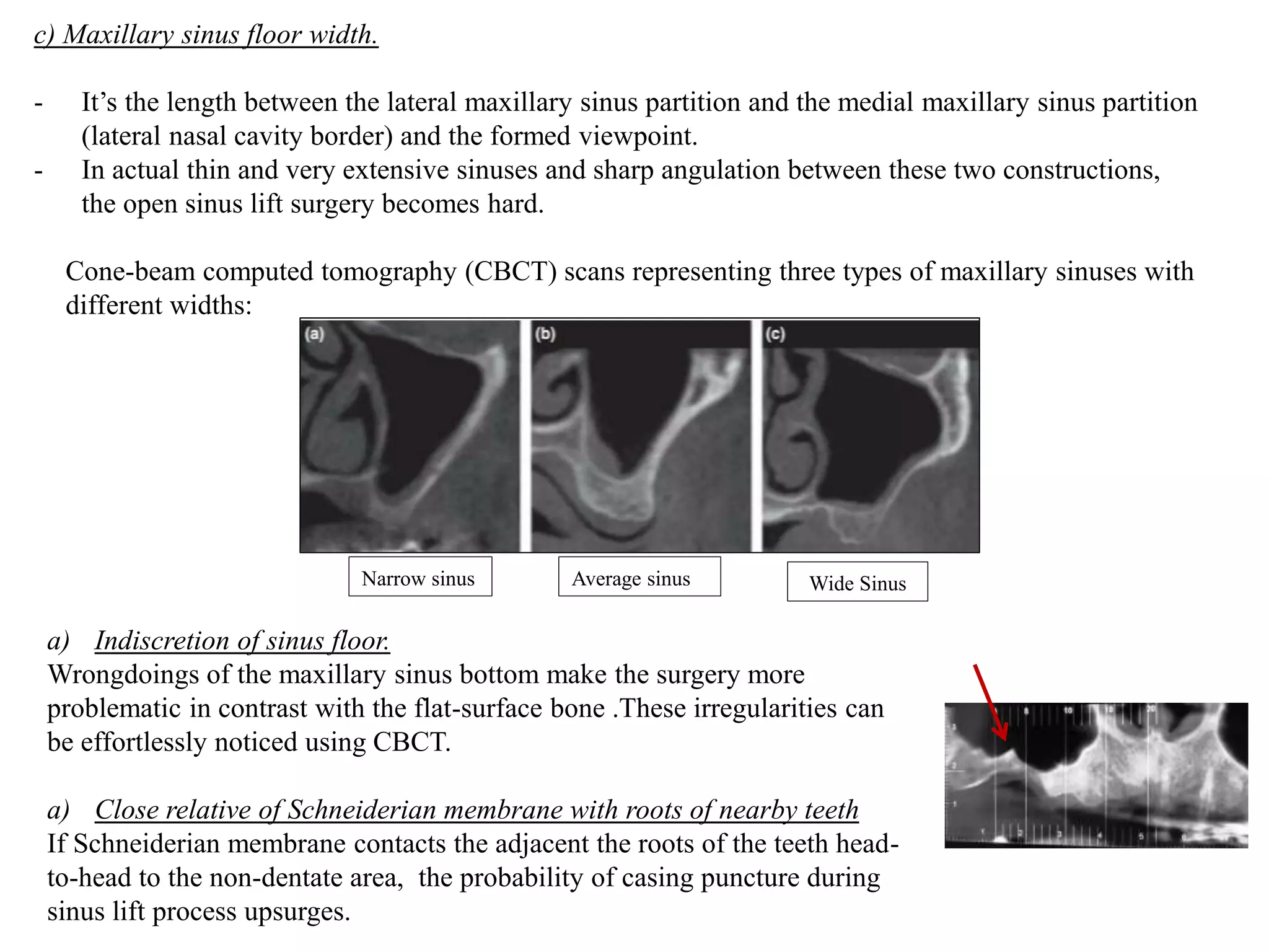 CBCT in Implants- Summary | PPTX