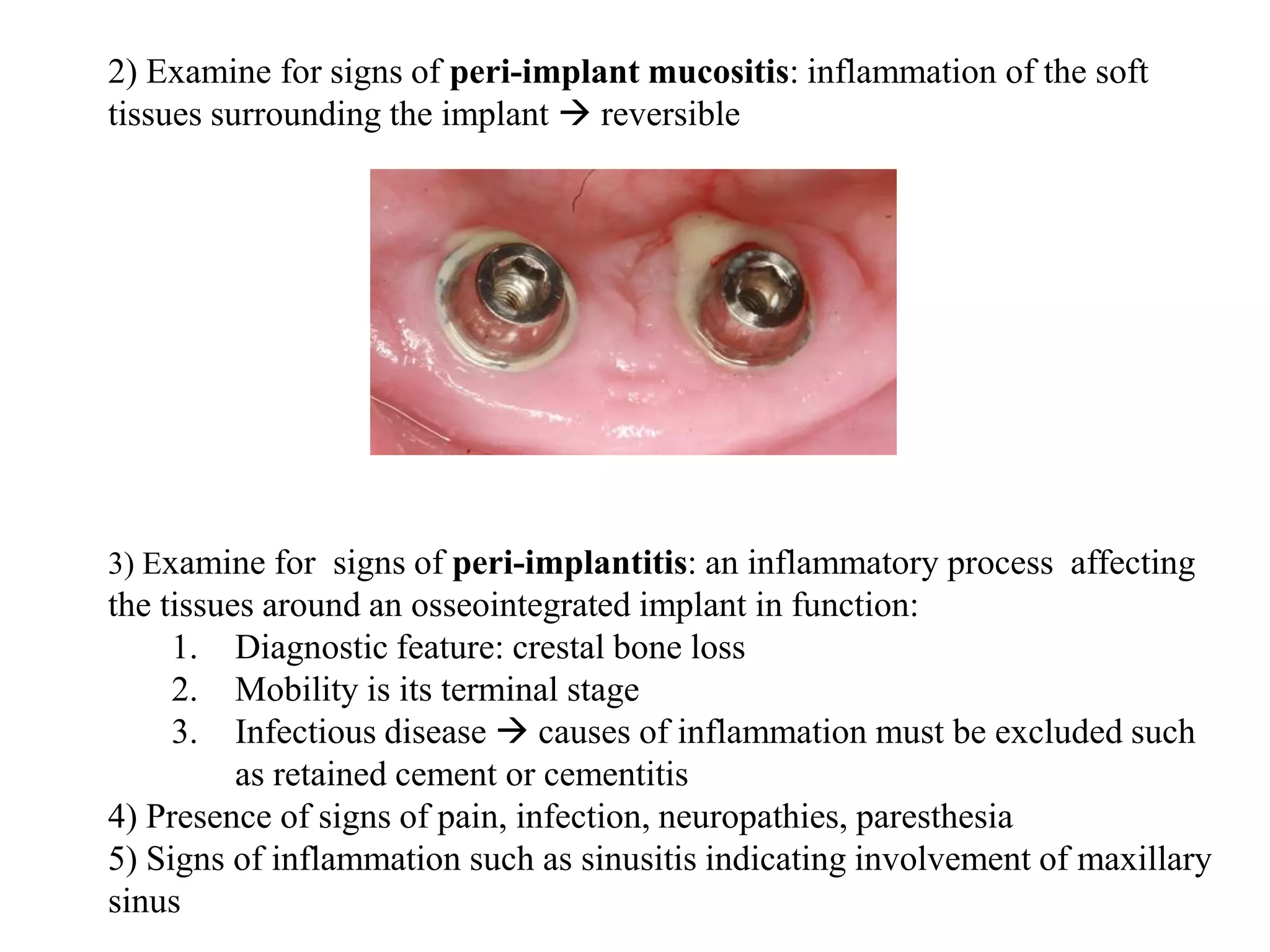 CBCT in Implants- Summary | PPTX