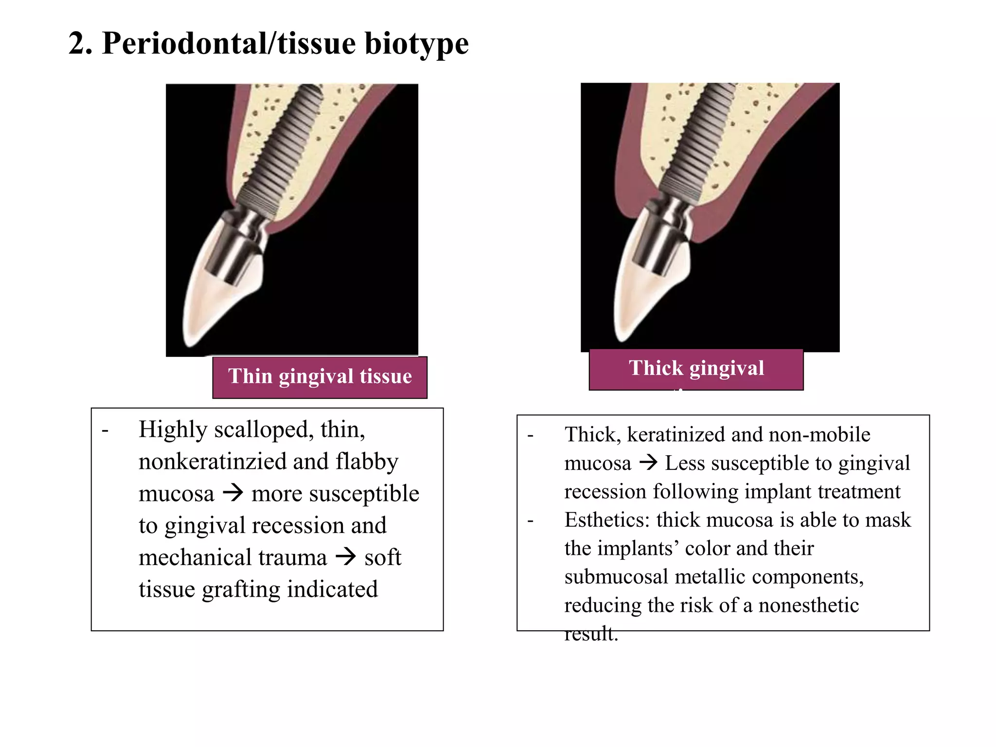 CBCT in Implants- Summary | PPTX