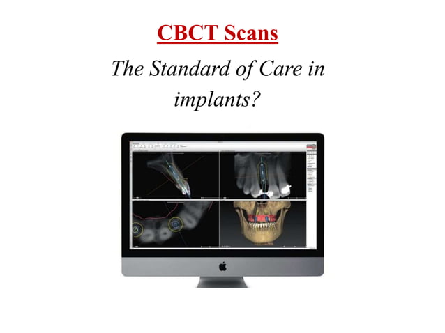 CBCT in Implants- Summary | PPTX | Dental Health | Diseases and Conditions