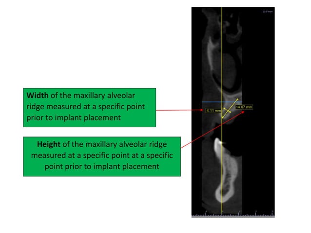 CBCT in Implants- Summary | PPTX | Dental Health | Diseases and Conditions