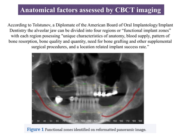 CBCT in Implants- Summary | PPTX | Dental Health | Diseases and Conditions
