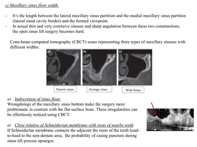 CBCT in Implants- Summary | PPTX | Dental Health | Diseases and Conditions