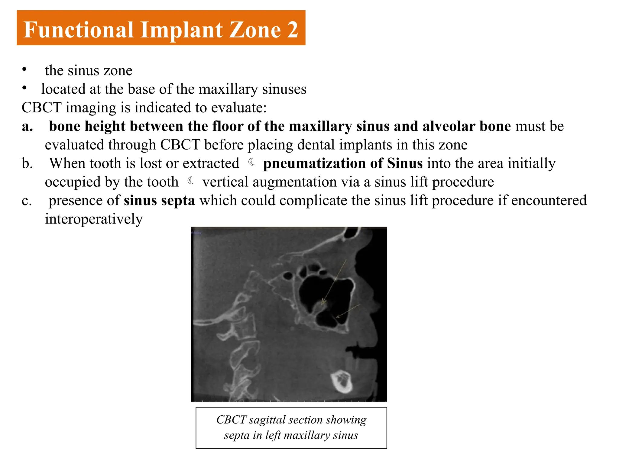 summary of cbct in implant dentistry.pptx