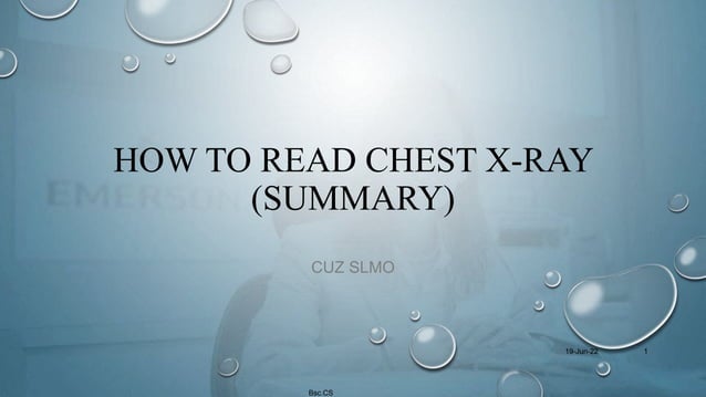 SUMMARY ON HOW TO READ CHEST X-RAY.pdf