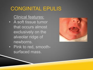 Summary (pediatric oral pathology) | PPTX