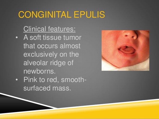 Summary (pediatric oral pathology)