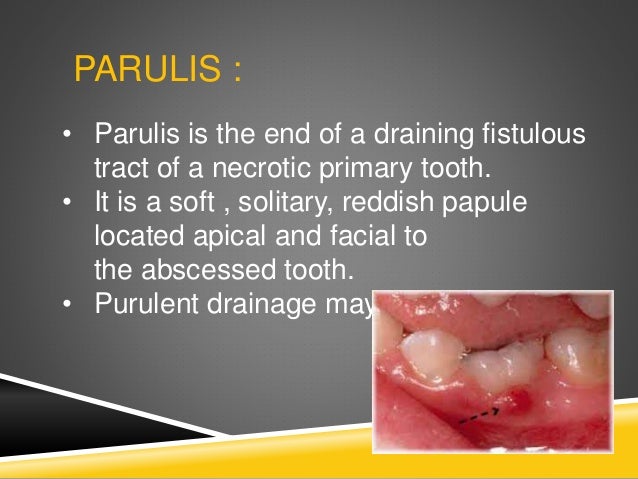 Summary (pediatric oral pathology)