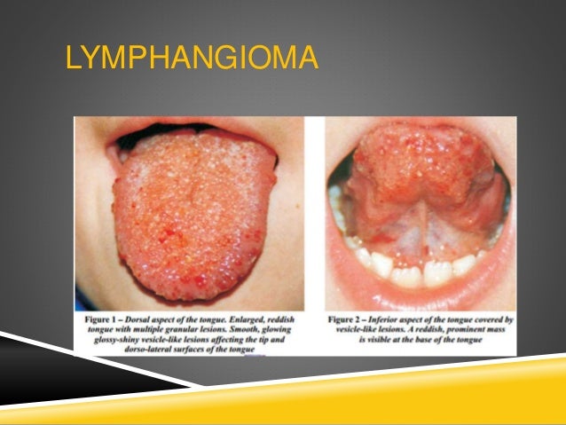 Summary (pediatric oral pathology)