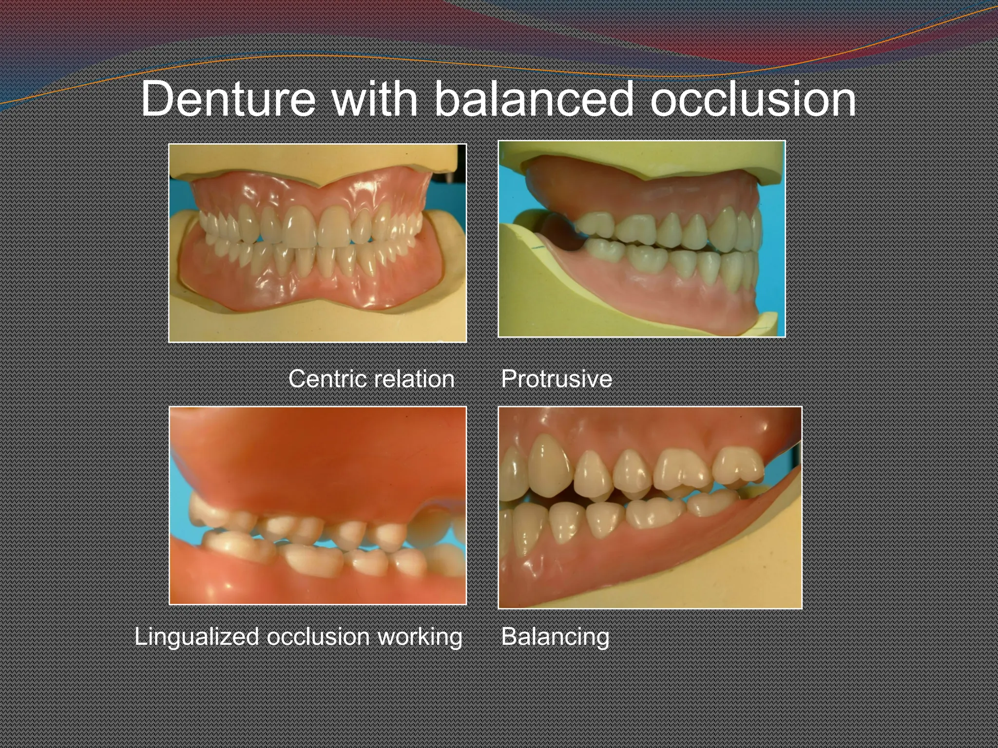 Summary Programming in complete denture. | PPTX