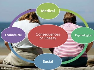 Obesity | PPT