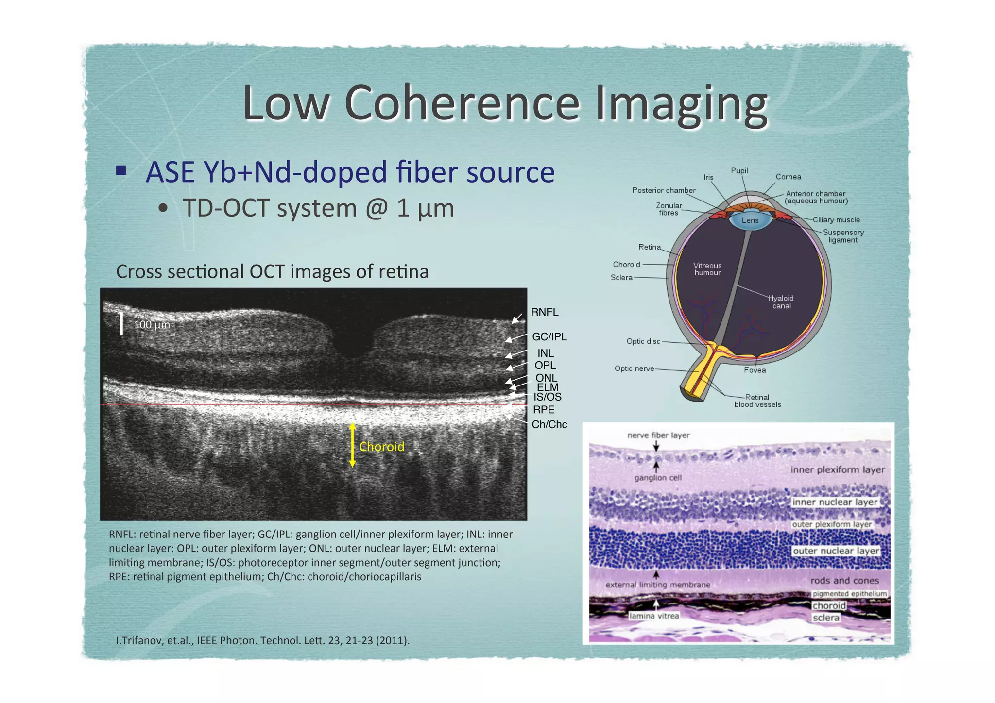 Low Coherence Interferometry: From Sensor Multiplexing to Biomedical Imaging | PDF | Physics ...