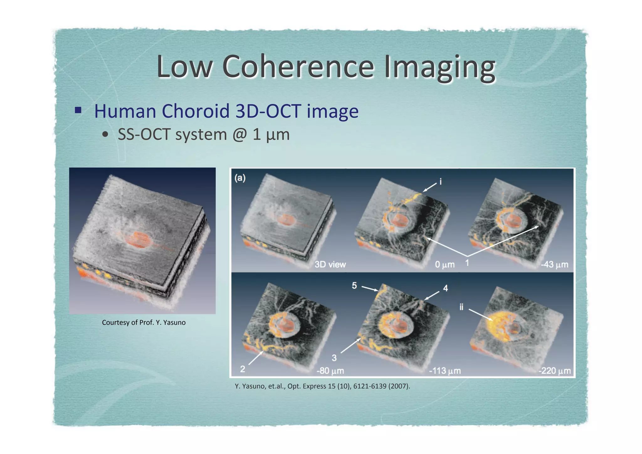 Low Coherence Interferometry: From Sensor Multiplexing to Biomedical Imaging | PDF | Physics ...