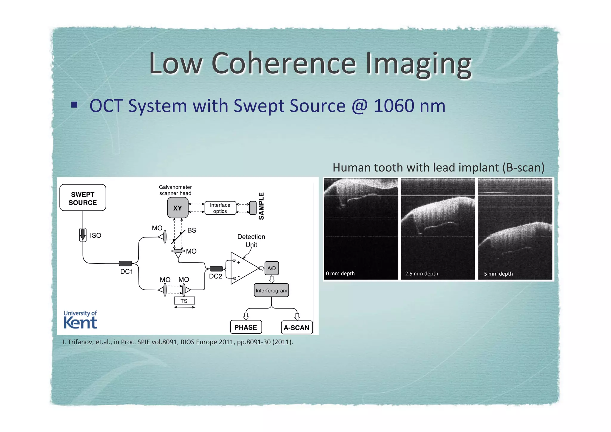 Low Coherence Interferometry: From Sensor Multiplexing to Biomedical Imaging | PDF | Physics ...