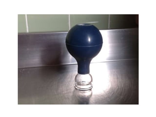 AWS treatment: a proposal | PPT