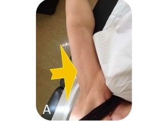 AWS treatment: a proposal | PPT