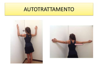 AWS treatment: a proposal | PPT